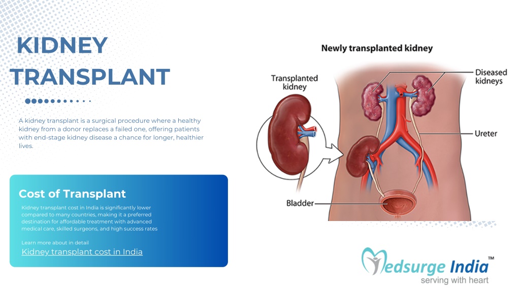 PPT - Kidney Transplant Cost In India PowerPoint Presentation, free ...