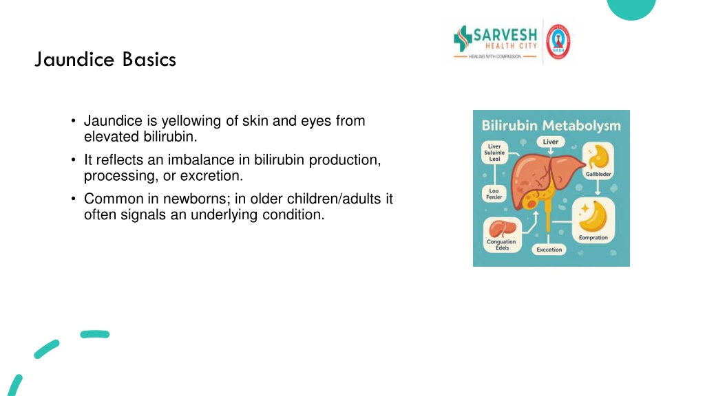 PPT - When to Visit a Specialist for Jaundice Management PowerPoint ...
