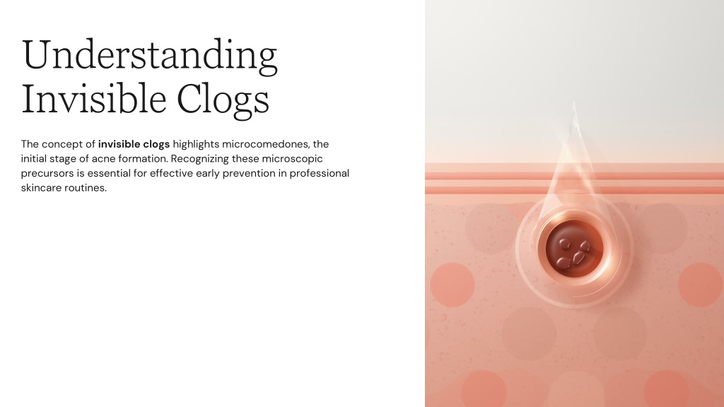 PPT - Presentation - The Invisible Clog PowerPoint Presentation, free ...