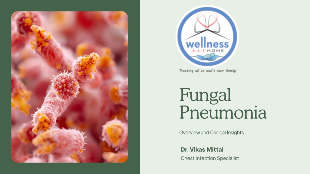 PPT - Lung & Chest Infection Specialist in Delhi - Fungal Pneumonia ...