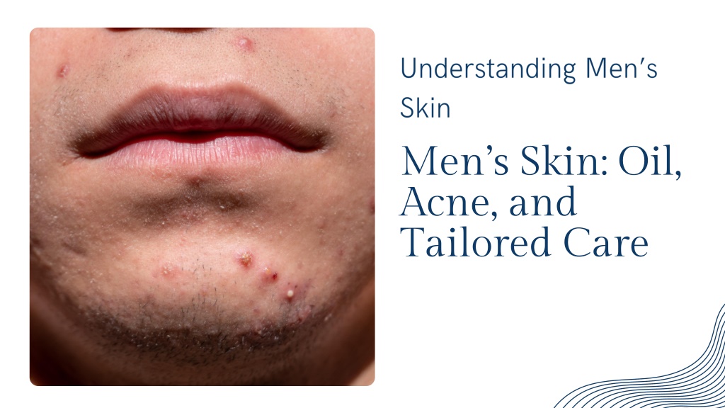 PPT - Presentation - Men’s Skin Oil, Acne, and Tailored Care PowerPoint ...