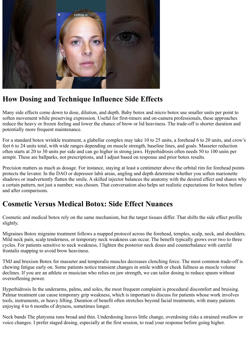 PPT - Botox Side Effects: Common, Rare, and How to Manage Them ...