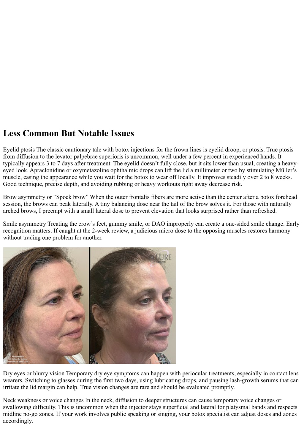 PPT - Botox Side Effects: Common, Rare, and How to Manage Them ...