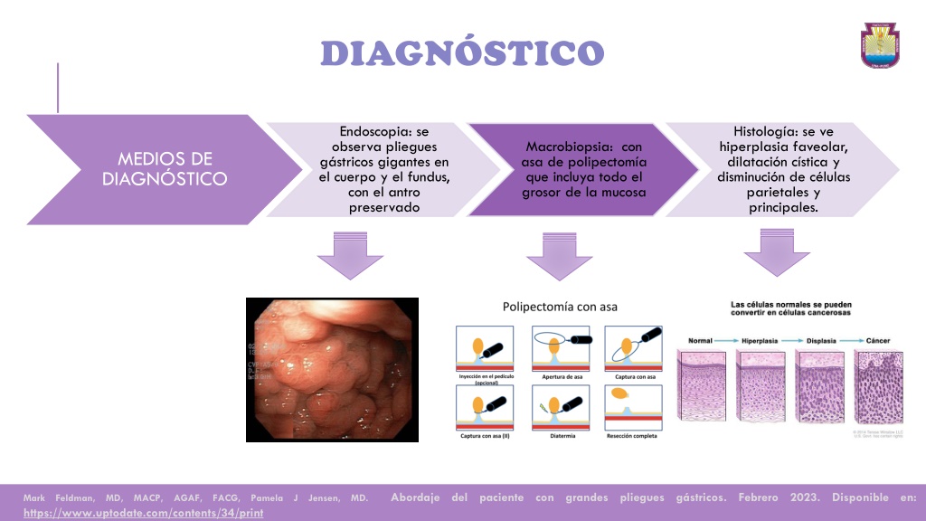 PPT - Enfermedad de Ménetrier_Dina Vanesa Ito Larico PowerPoint ...
