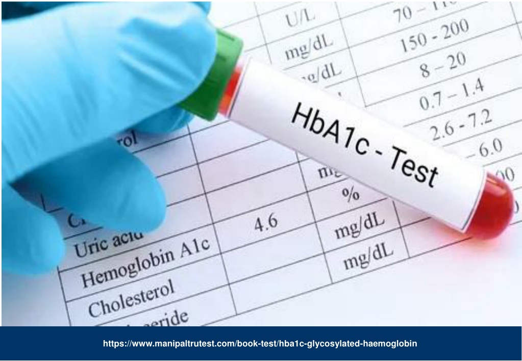 PPT - Book HbA1C Blood Test at Home PowerPoint Presentation, free ...