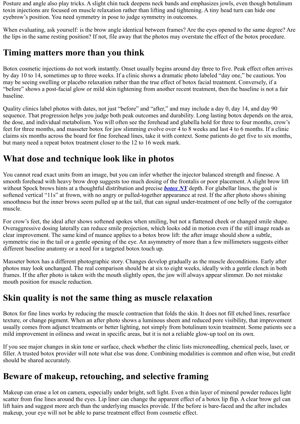 PPT - How to Read Botox Before-and-After Photos Critically PowerPoint ...