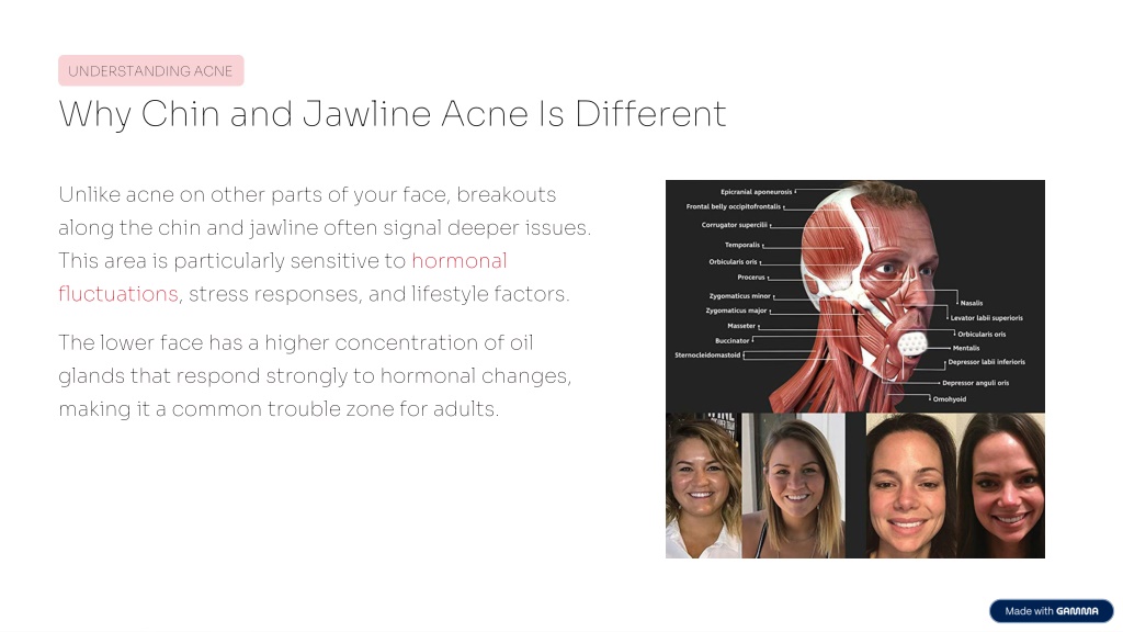 PPT - Chin and Jawline Acne What Your Skin Is Trying to Tell You ...