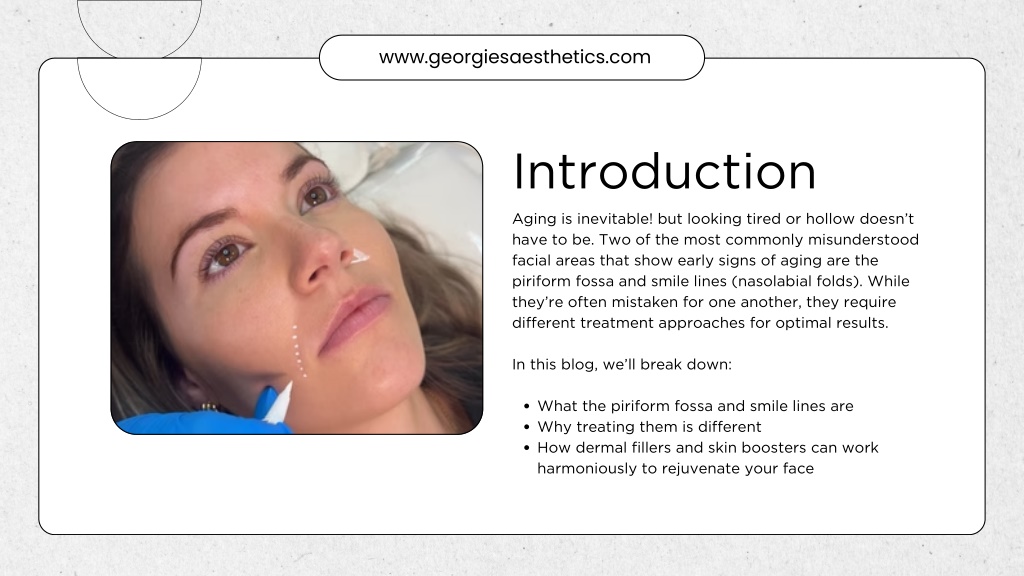 PPT - Piriform Fossa vs. Smile Lines What’s the Difference and How Do ...
