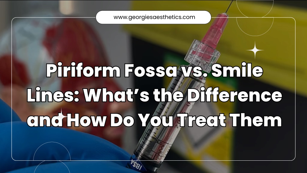 PPT - Piriform Fossa vs. Smile Lines What’s the Difference and How Do ...
