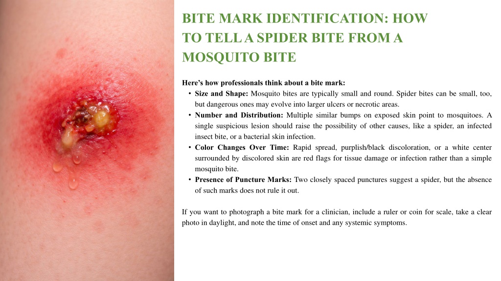 PPT - Identifying Spider and Mosquito Bites for Proper Treatment ...
