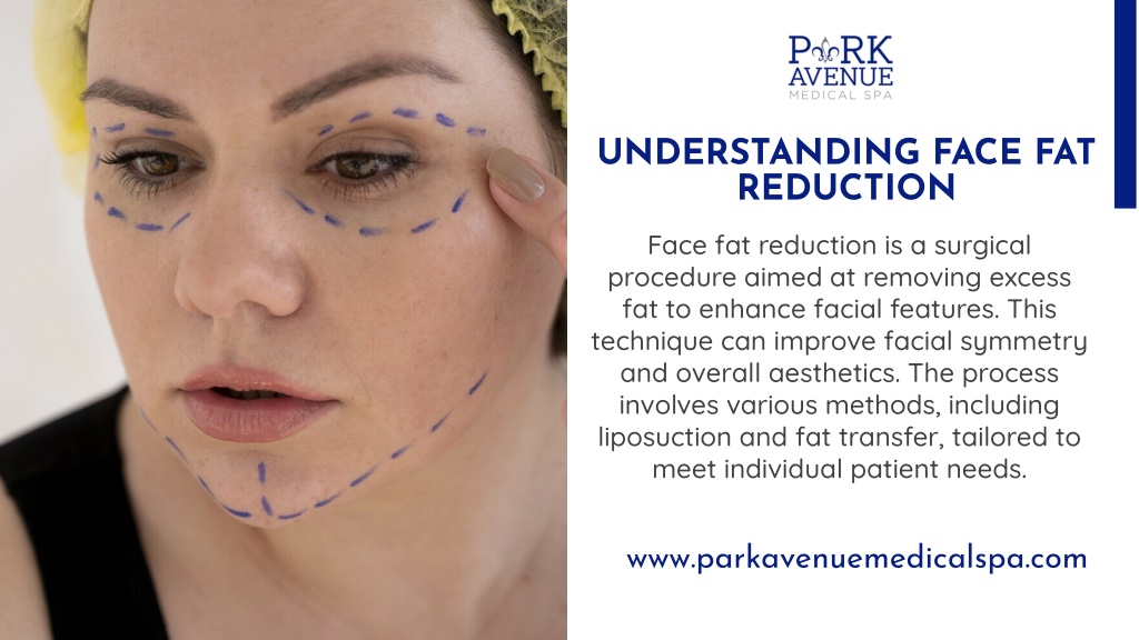 PPT - A Comprehensive Overview of Face Fat Reduction Surgery PowerPoint ...