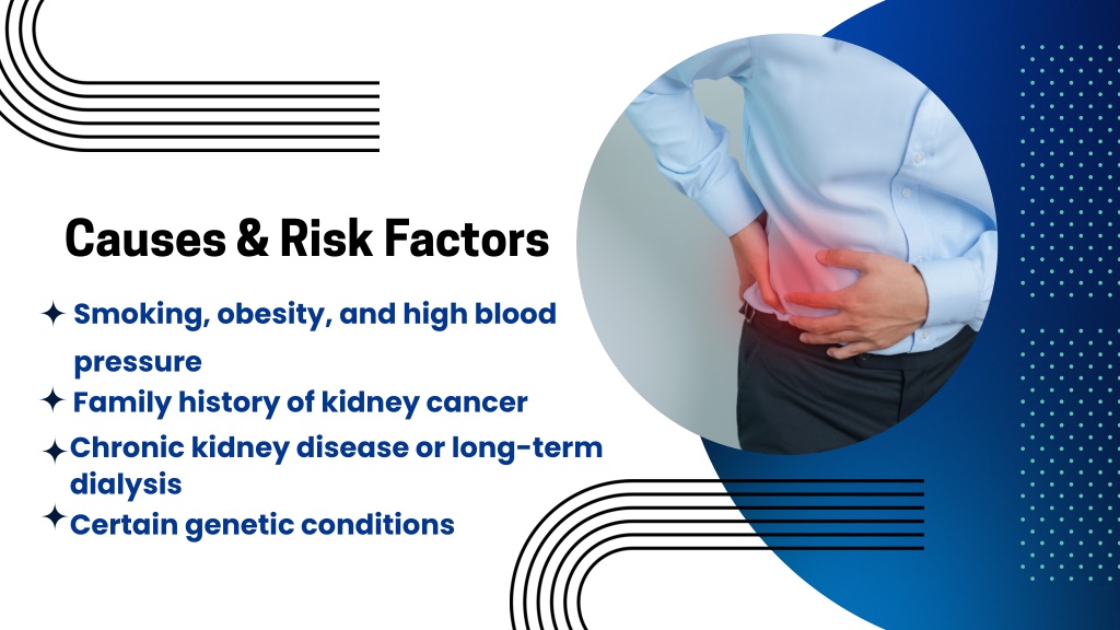 PPT - How do lifestyle factors like smoking or obesity affect kidney ...