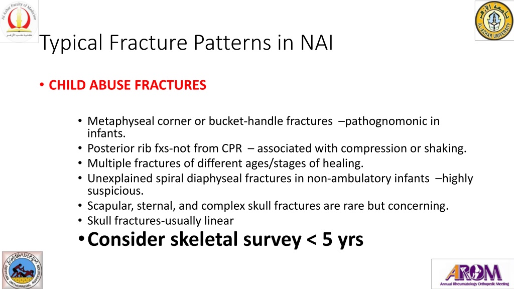 PPT - Non-Accidental Injury in Pediatrics Pitfalls in Diagnosis and ...